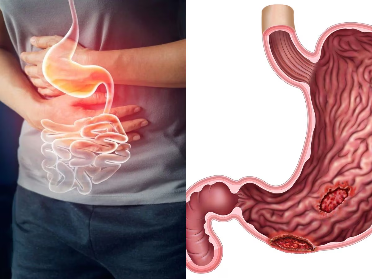 Stomach bloating, belching, nausea, vomiting; never ignore, recognize ...