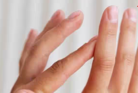 If you see black lines on your nails, don't ignore them; they could be ...